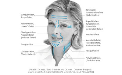 Faltenbehandlung mit Botox in Bad Füssing – Hausärztliche Versorgung ...